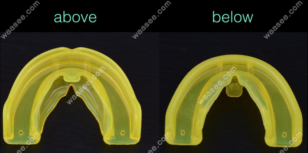 mrc一共几个阶段?mrc早期干预三个阶段价格1.5w起/一般需戴2年 - 口腔资讯 - 牙齿矫正网