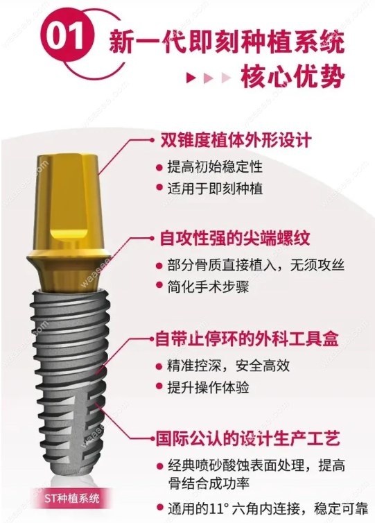 T-plus是台湾产贴牌瑞士吗?不,Tplus属于士卓曼中低档次种植体 - 口腔资讯 - 牙齿矫正网